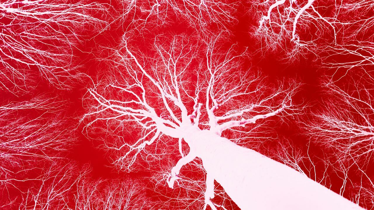 At Home Echolight Rems Bone Density Scan - Carolina Skeletal Solutions